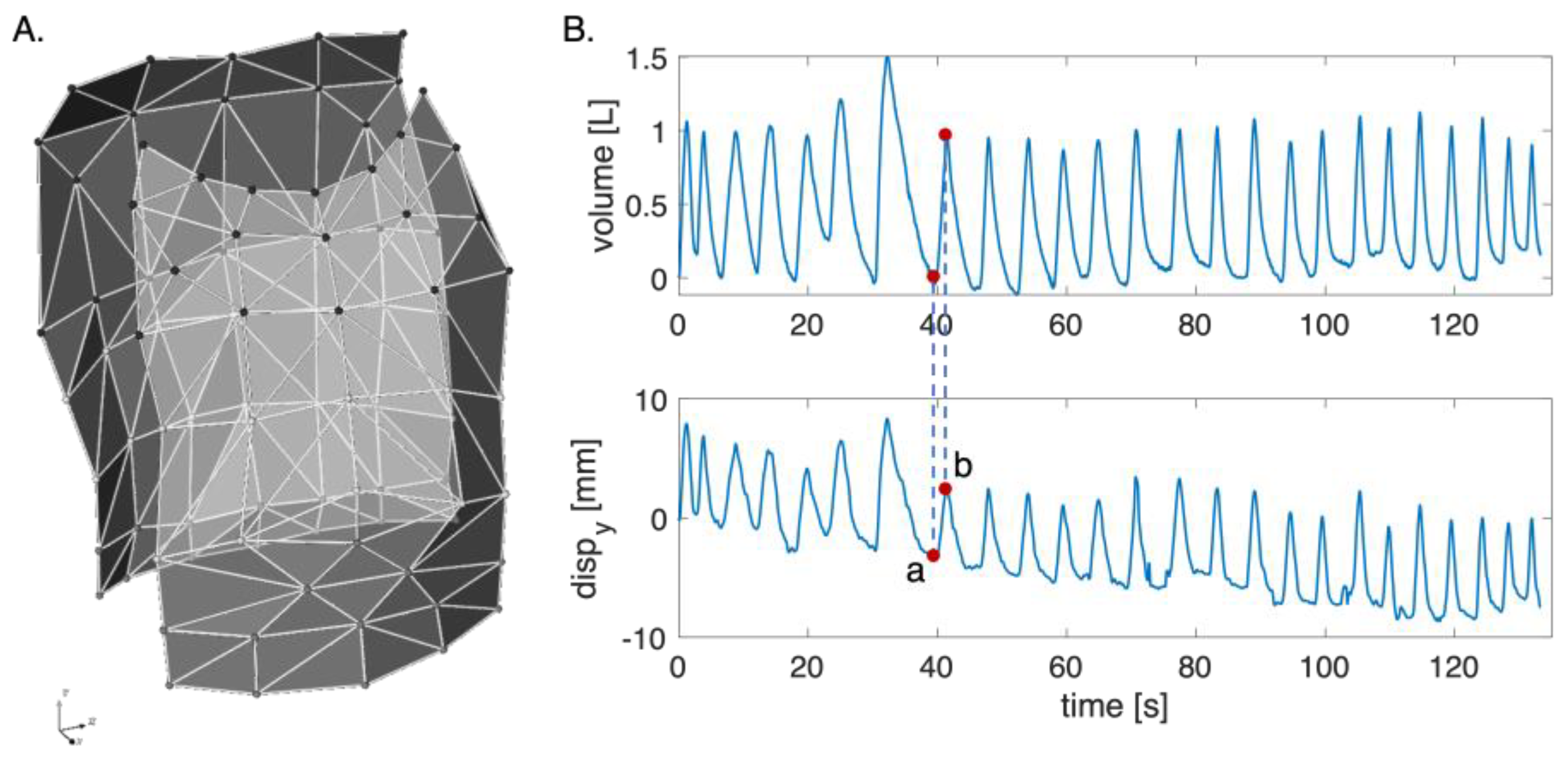 Breathing Chest Wall Kinematics Assessment through a Single Digital ...