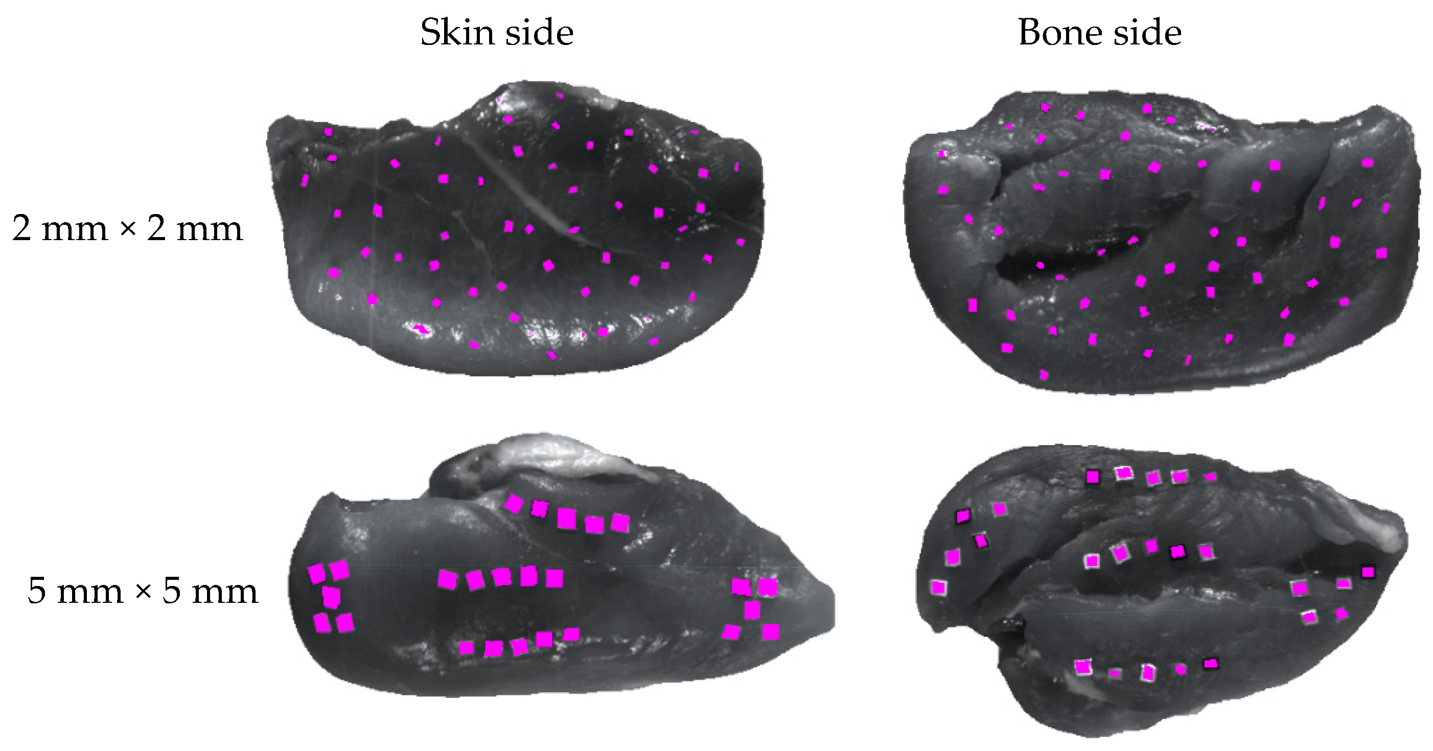 Semisupervised Deep Learning for the Detection of Foreign Materials on ...