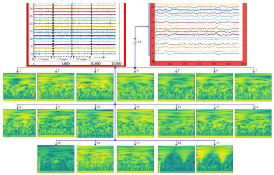 LSGP-USFNet: Automated Attention Deficit Hyperactivity Disorder Detection Using Locations of ...