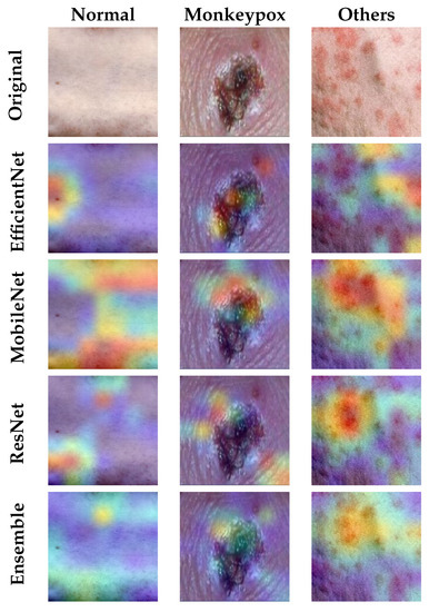A Robust Ensemble of Convolutional Neural Networks for the Detection of Monkeypox Disease from ...