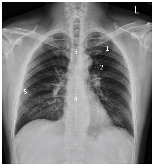 Investigation of the Relationship between Body Parameters and mAs Using ...