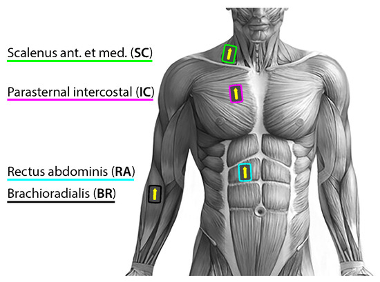 Wavelet Analysis of Respiratory Muscle sEMG Signals during the ...
