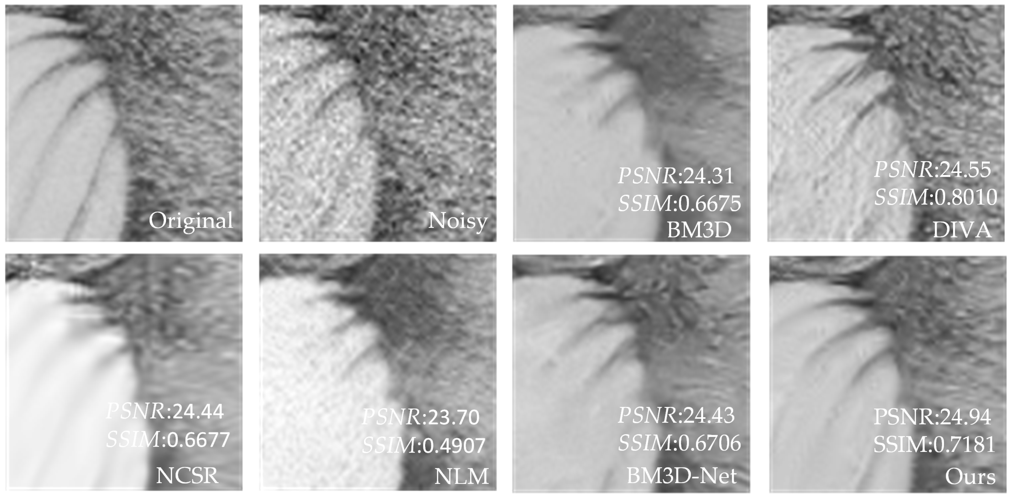 An Improved Bm3d Algorithm Based On Image Depth Feature Map And 1740