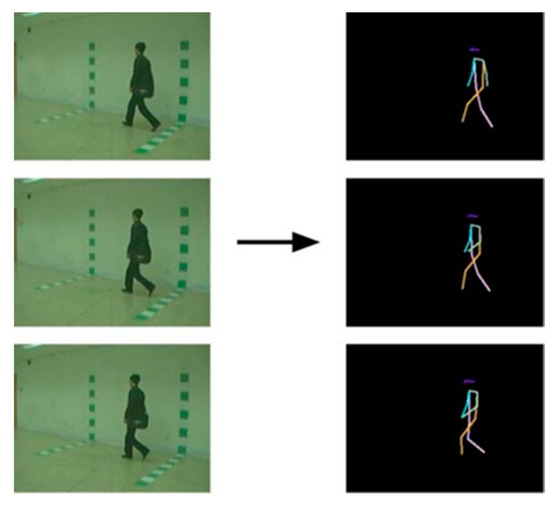 Sensors | Free Full-Text | Research Method of Discontinuous-Gait Image Recognition Based on ...