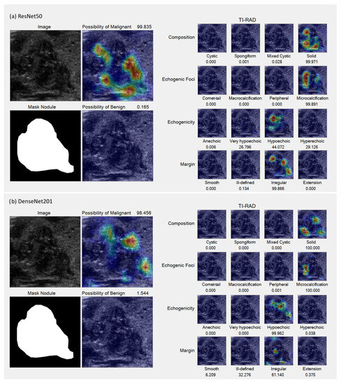 Explainable Automated TI-RADS Evaluation of Thyroid Nodules