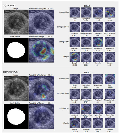 Explainable Automated TI-RADS Evaluation of Thyroid Nodules