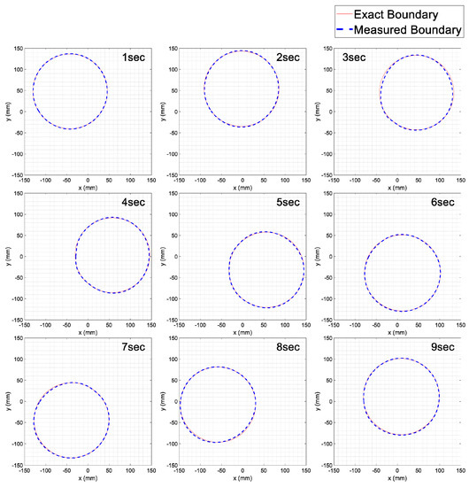 Body Boundary Measurement Using Multiple Line Lasers for a Focused ...
