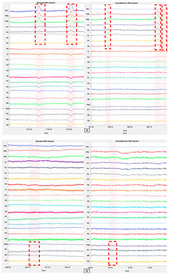 Introducing a New Mobile Electroencephalography System and Evaluating ...