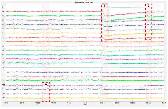 Introducing a New Mobile Electroencephalography System and Evaluating ...