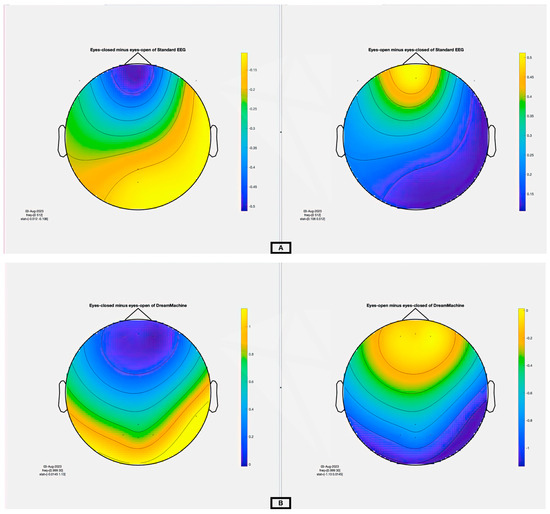 Introducing a New Mobile Electroencephalography System and Evaluating ...