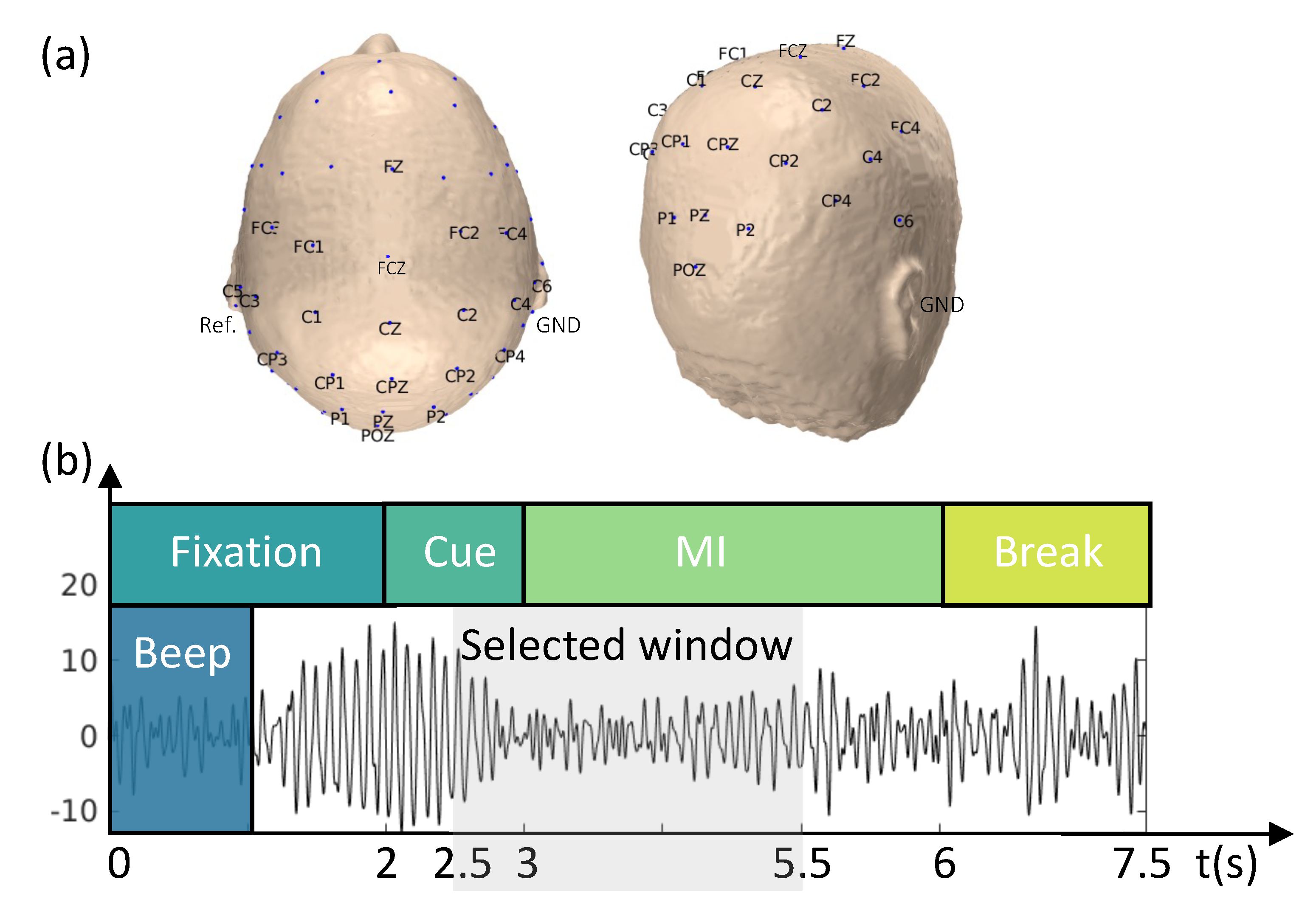 Sensors | Free Full-Text | Functional Connectivity and Feature Fusion Enhance Multiclass Motor ...