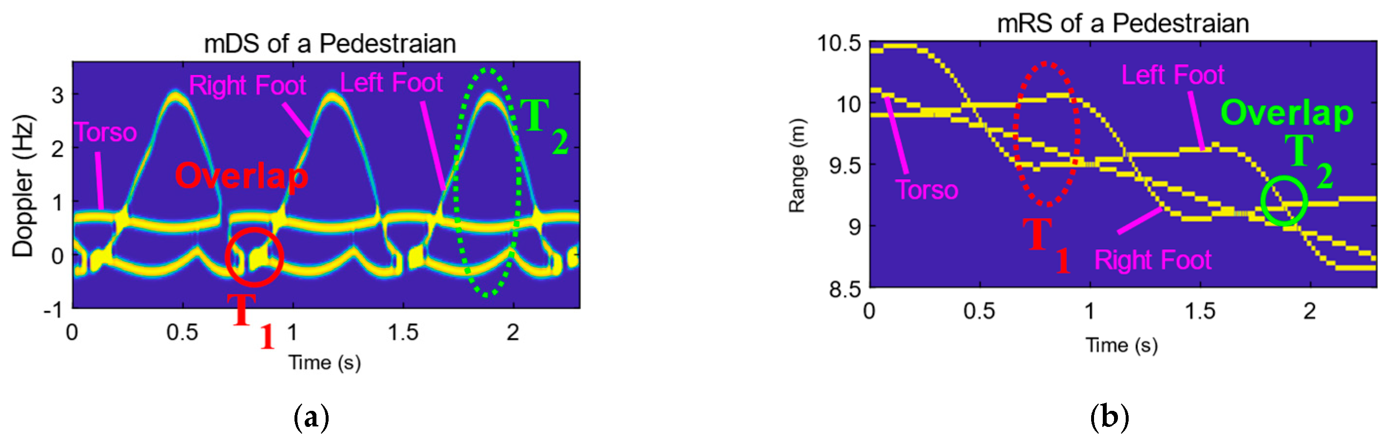 Extraction Of Human Limbs Based On Micro Doppler Range Trajectories Using Wideband