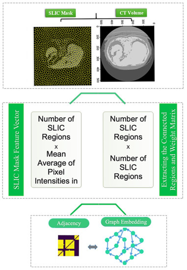 Sensors | Free Full-Text | Automatic Liver Tumor Segmentation from CT ...