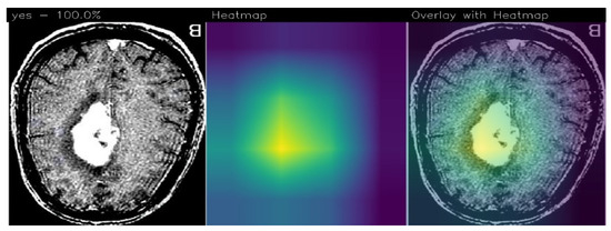 Sensors | Free Full-Text | Explainable Convolutional Neural Networks ...