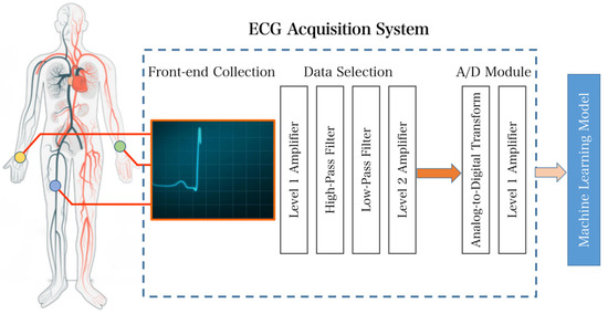An ECG Signal Acquisition and Analysis System Based on Machine Learning with Model Fusion