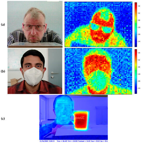 Non-Contact Face Temperature Measurement by Thermopile-Based Data Fusion