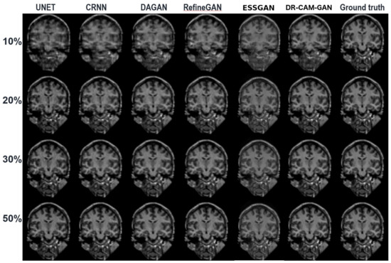CS-MRI Reconstruction Using an Improved GAN with Dilated Residual Networks and Channel Attention ...