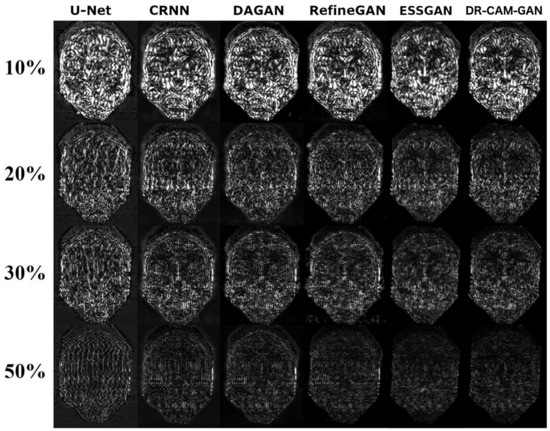 CS-MRI Reconstruction Using an Improved GAN with Dilated Residual ...