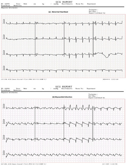 Efficient Classification of ECG Images Using a Lightweight CNN with Attention Module and IoT