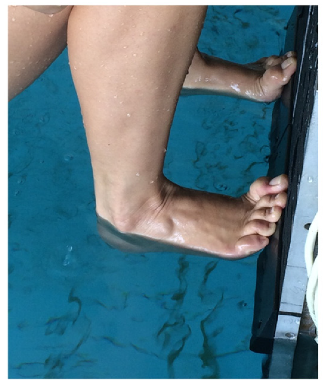 Swimmers’ Effective Actions during the Backstroke Start Technique