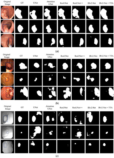 Sensors | Free Full-Text | IRv2-Net: A Deep Learning Framework for Enhanced Polyp Segmentation ...