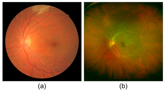 A Straightforward Bifurcation Pattern-Based Fundus Image Registration ...