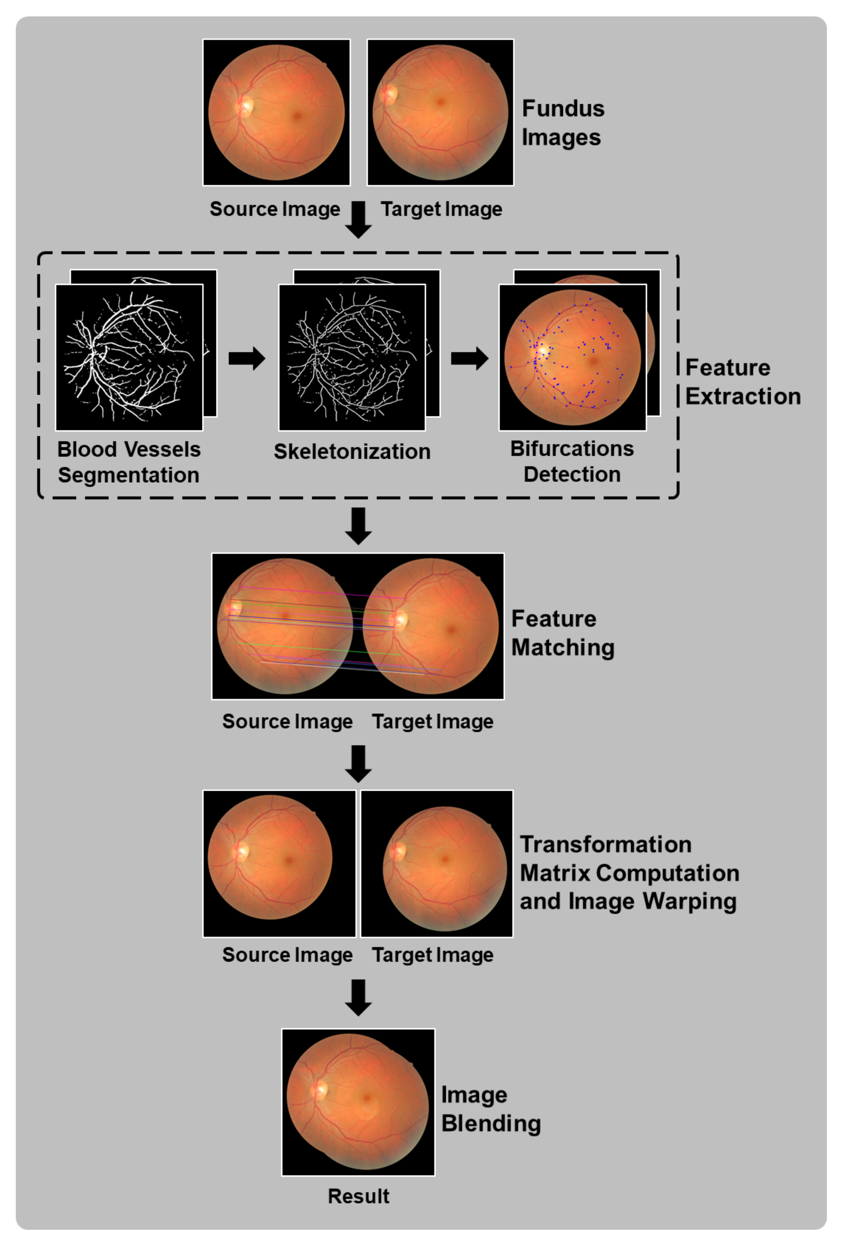 A Straightforward Bifurcation Pattern-Based Fundus Image Registration ...