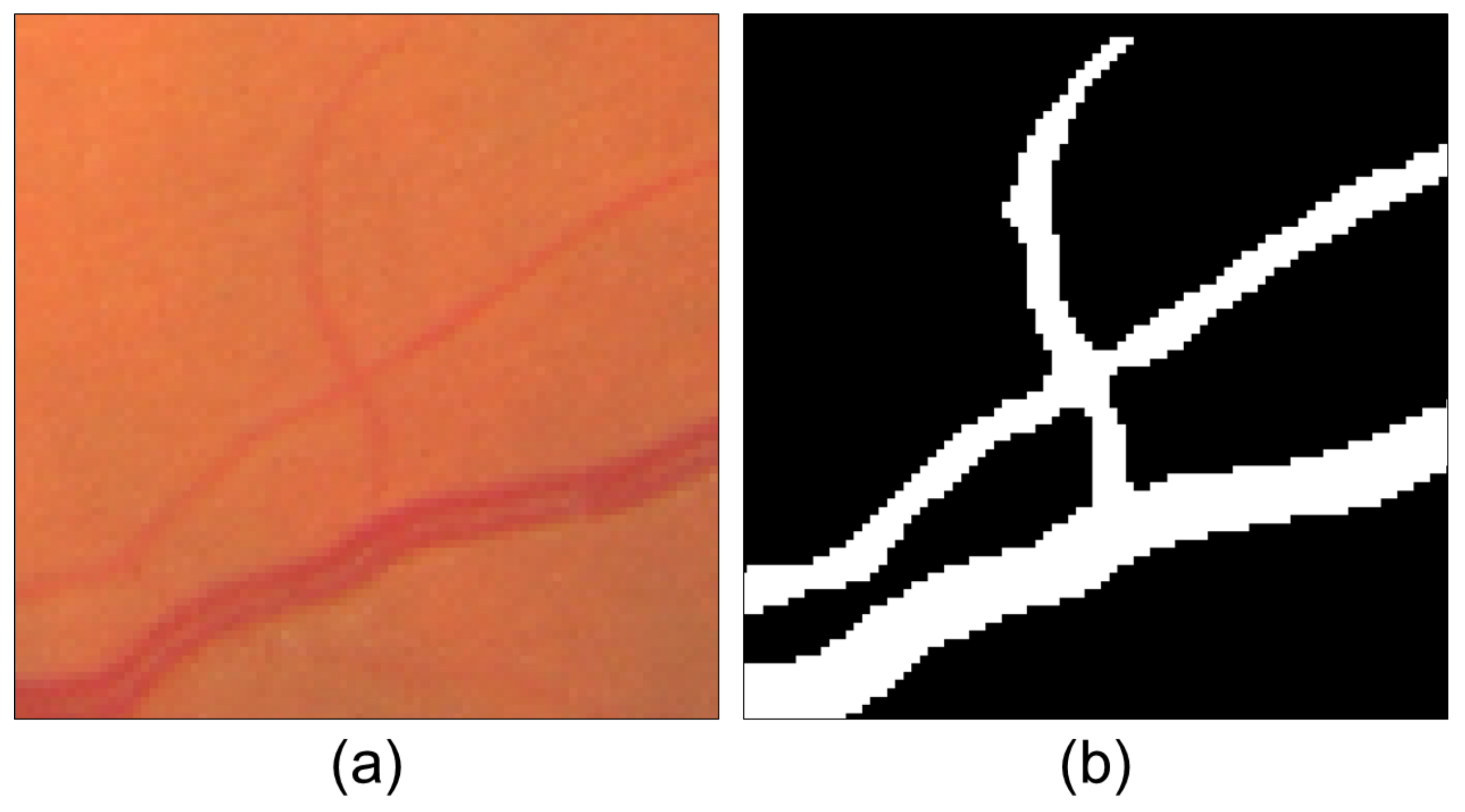 A Straightforward Bifurcation Pattern-Based Fundus Image Registration ...