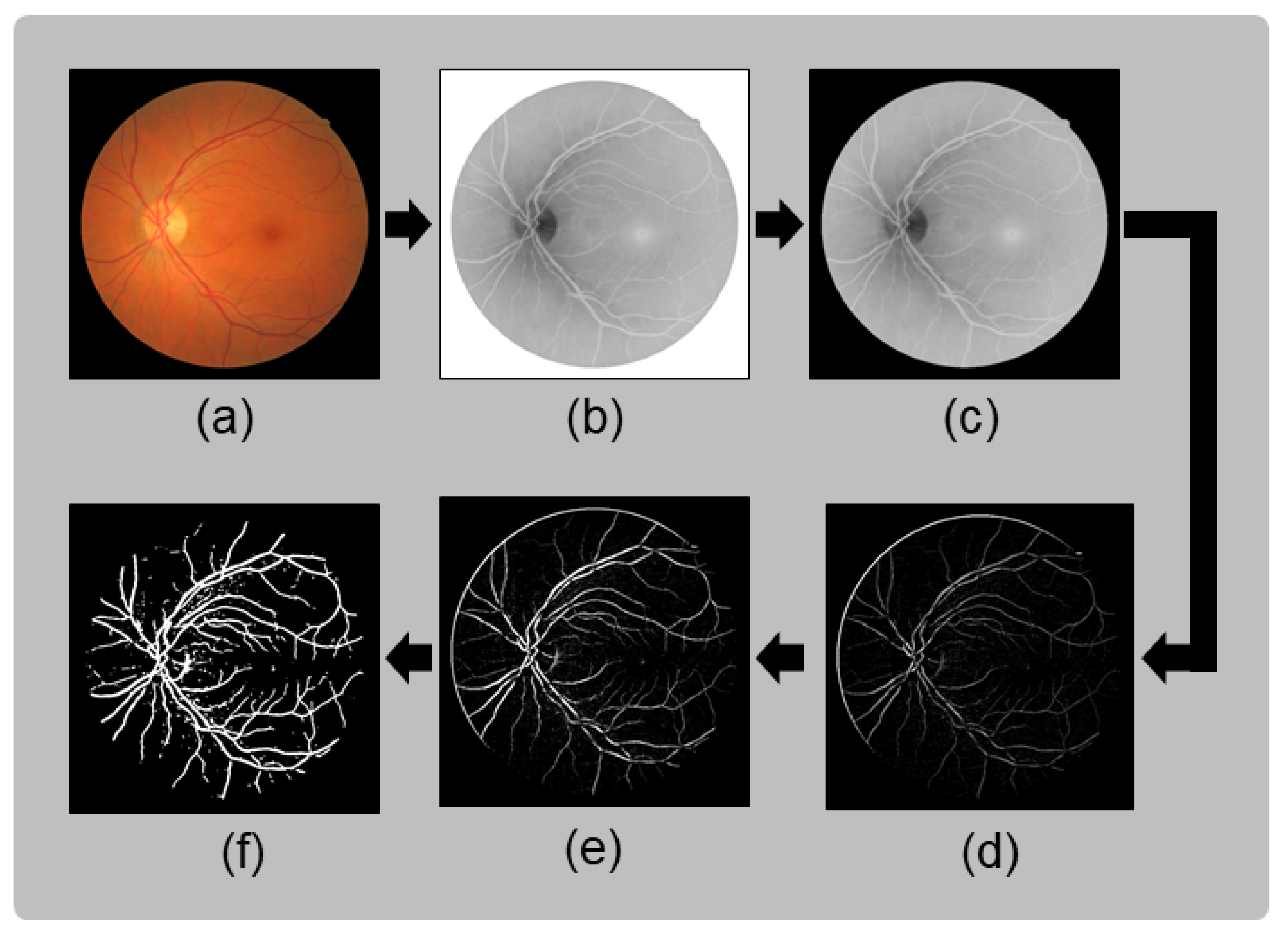 A Straightforward Bifurcation Pattern-Based Fundus Image Registration ...