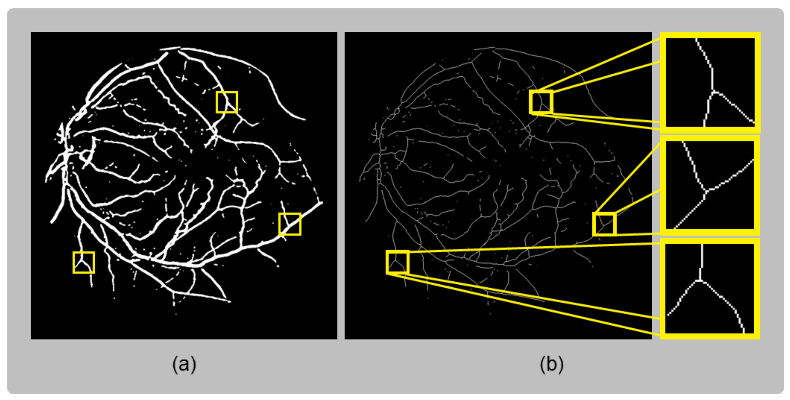 A Straightforward Bifurcation Pattern-Based Fundus Image Registration ...