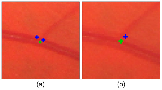 A Straightforward Bifurcation Pattern-Based Fundus Image Registration ...