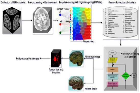 Sensors | Free Full-Text | An Efficient Brain Tumor Segmentation Method Based on Adaptive Moving ...