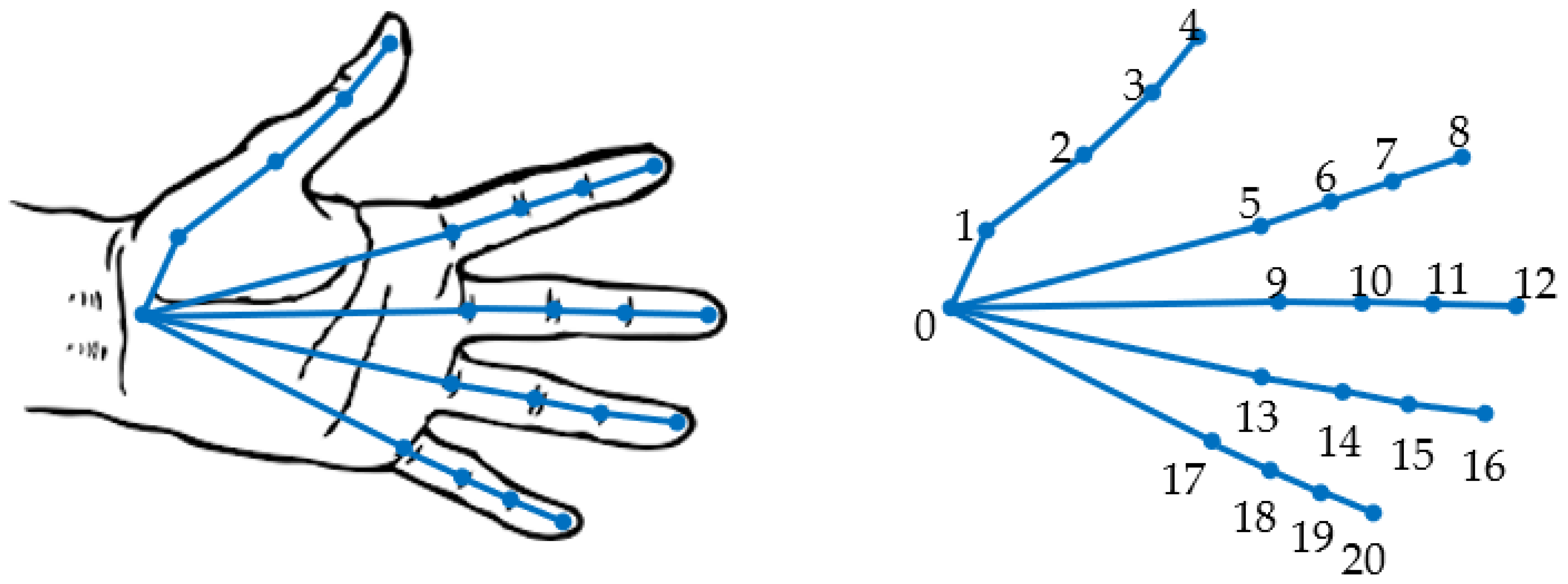 Automatic Multiview Alignment of RGB-D Range Maps of Upper Limb Anatomy