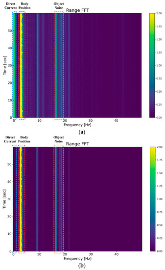 MAE-Based Self-Supervised Pretraining Algorithm for Heart Rate Estimation of Radar Signals
