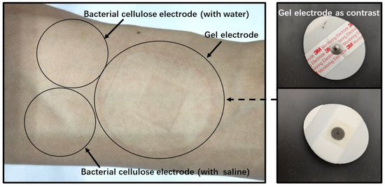 A Film Electrode upon Nanoarchitectonics of Bacterial Cellulose and ...