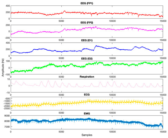Sensors | Free Full-Text | Deep Learning for Detecting Multi-Level Driver Fatigue Using ...