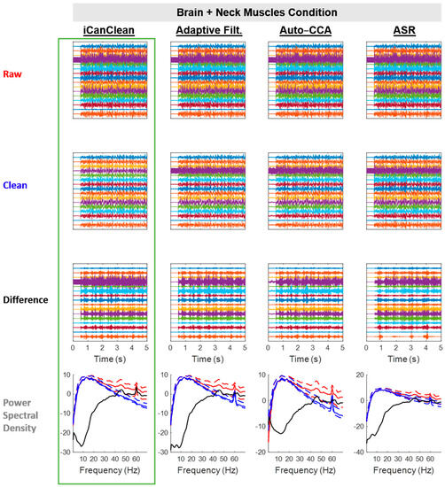 Sensors | Free Full-Text | iCanClean Removes Motion, Muscle, Eye, and ...