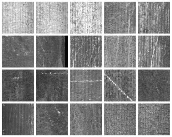 A Self-Supervised Model Based on CutPaste-Mix for Ductile Cast Iron ...