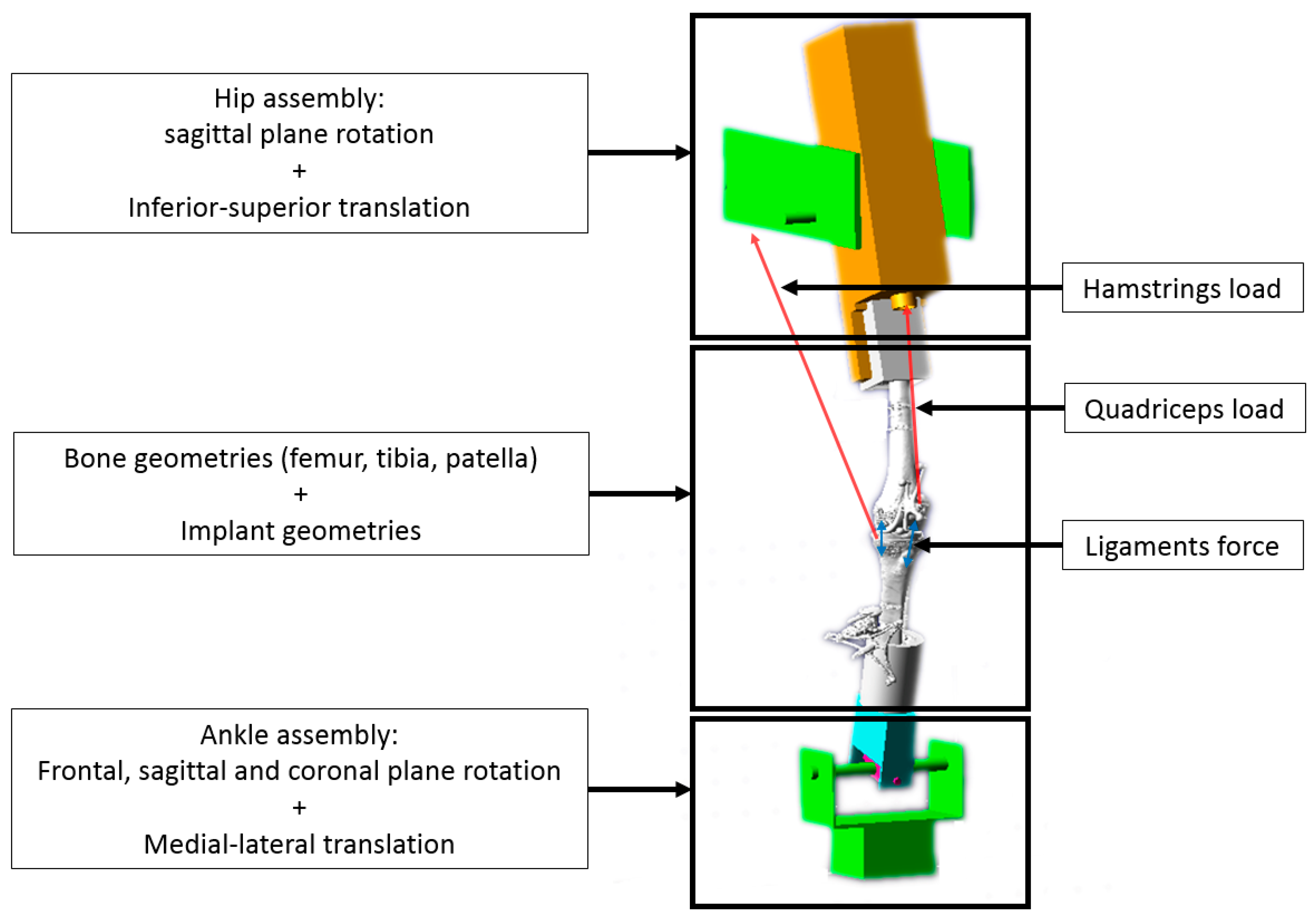 Sensitivity of Model-Based Predictions of Post-TKA Kinematic Behavior ...
