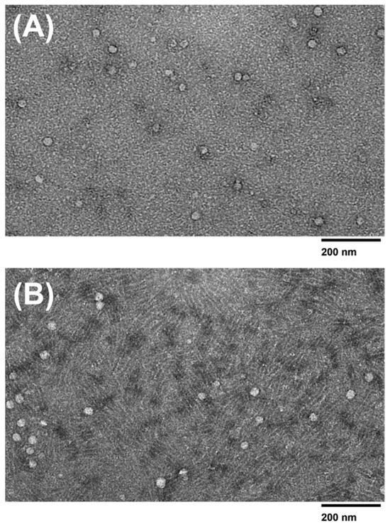 Sensors | Free Full-Text | Development of a Microfluidic Device for Exosome Isolation in Point ...