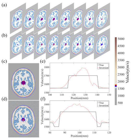 3D Ultrasonic Brain Imaging with Deep Learning Based on Fully ...