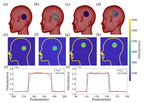 3D Ultrasonic Brain Imaging with Deep Learning Based on Fully ...
