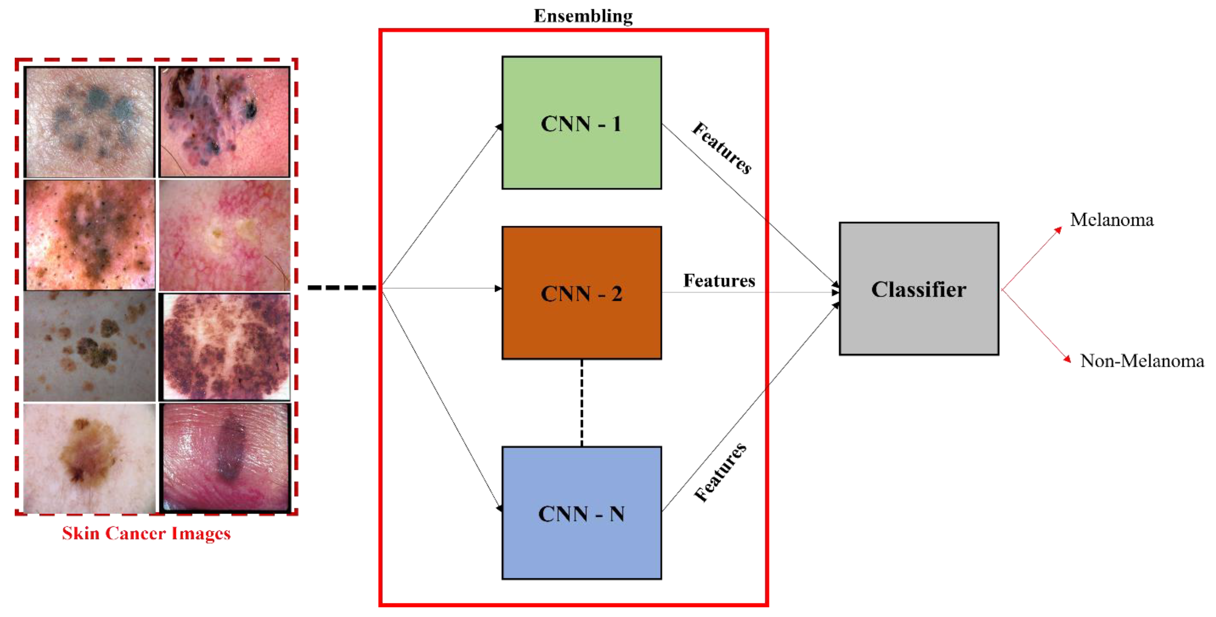 Sensors | Free Full-Text | Federated and Transfer Learning Methods for ...