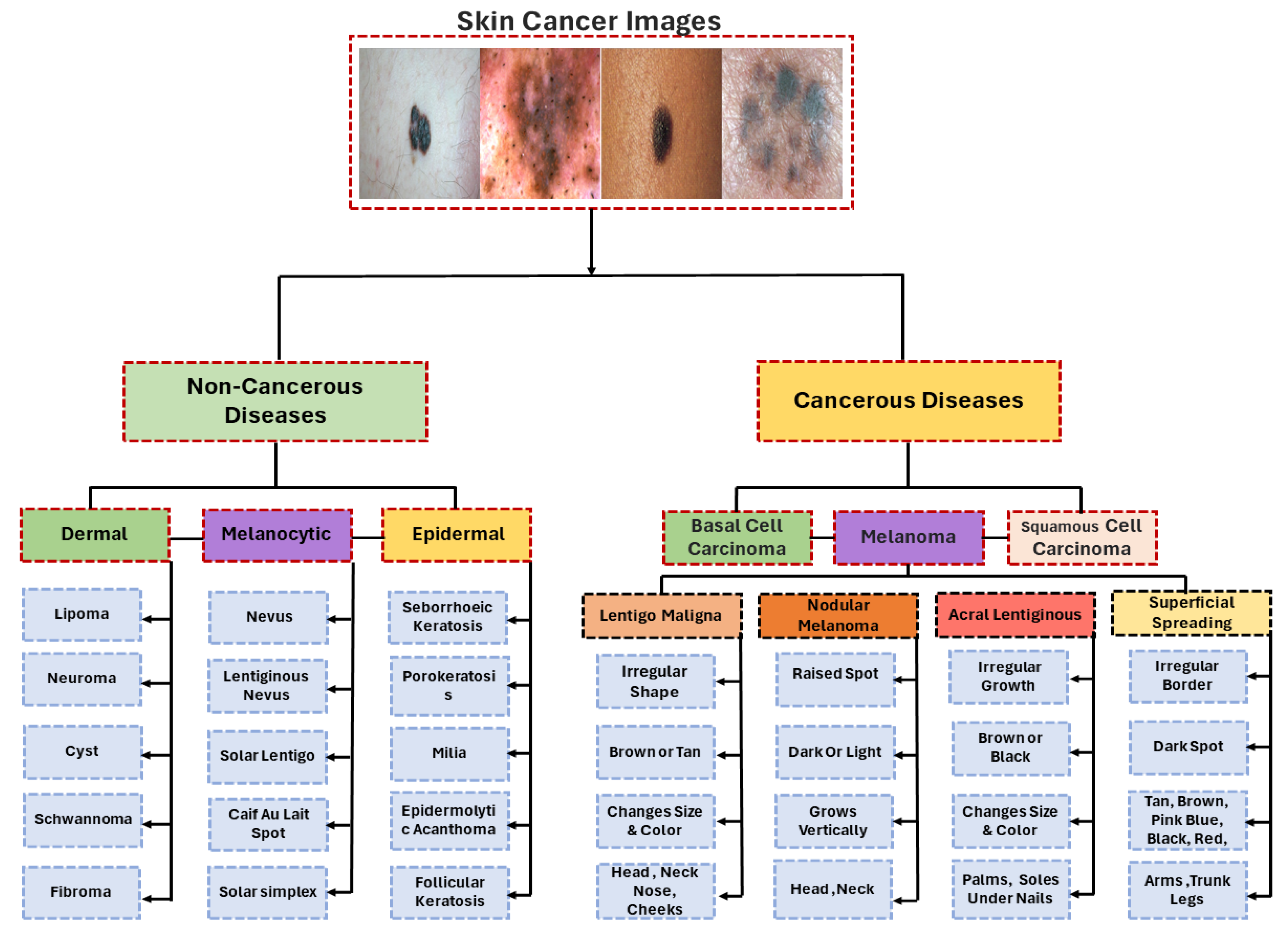 Sensors | Free Full-Text | Federated and Transfer Learning Methods for ...