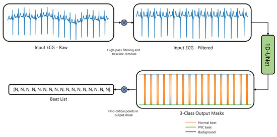 Sensors | Free Full-Text | End-to-End Premature Ventricular Contraction ...