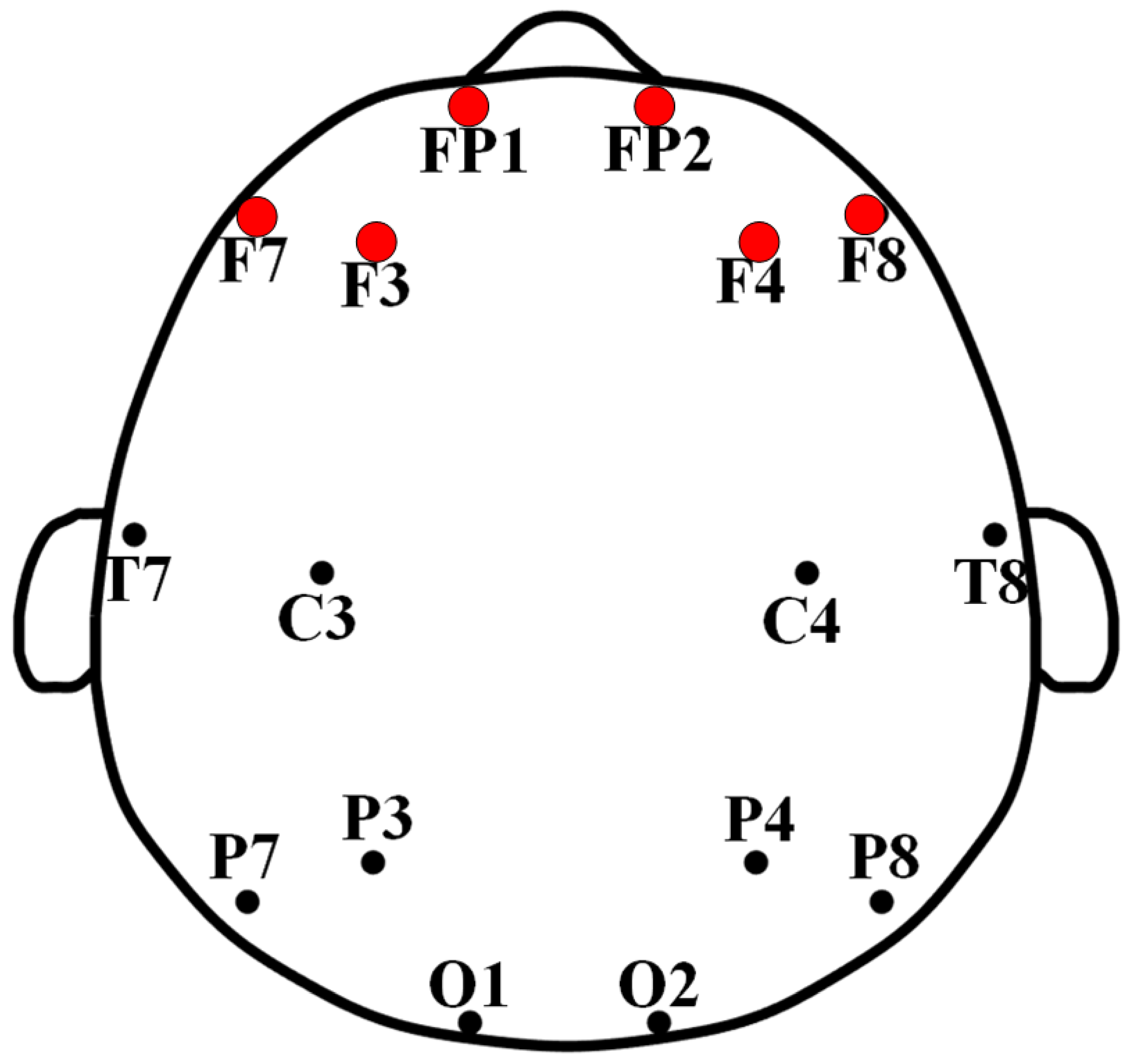 Depressive Disorder Recognition Based on Frontal EEG Signals and Deep ...