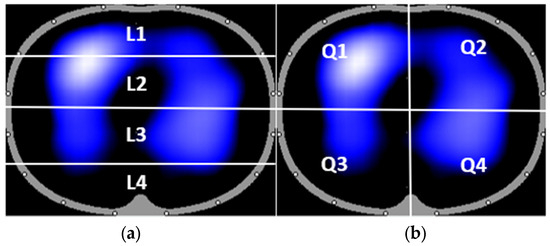 Cranial Electrode Belt Position Improves Diagnostic Possibilities of ...