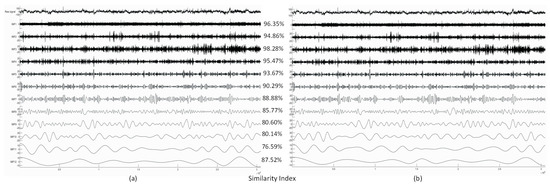 GPU Implementation of the Improved CEEMDAN Algorithm for Fast and Efficient EEG Time–Frequency ...