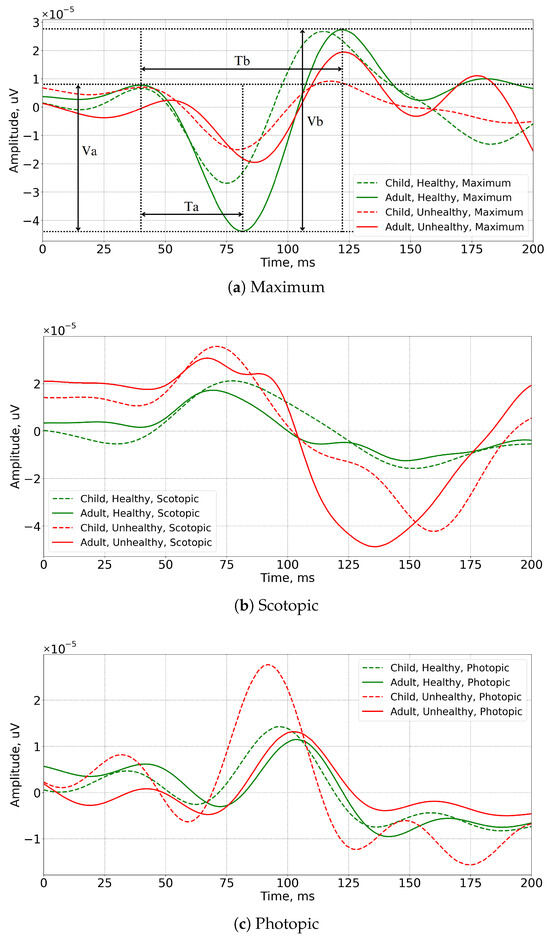 Enhancing Electroretinogram Classification with Multi-Wavelet Analysis and Visual Transformer