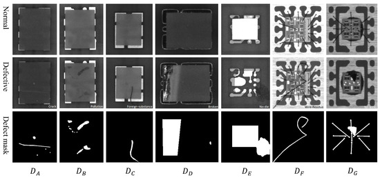 Anomaly Detection via Progressive Reconstruction and Hierarchical ...